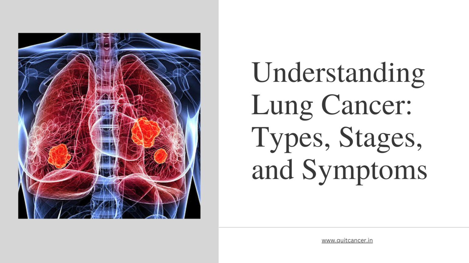 Lung Cancer: Types, Stages,Symptoms and Prevention